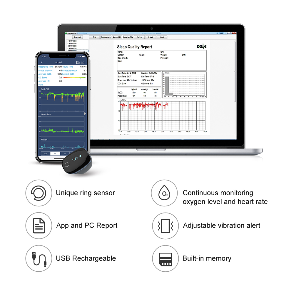 Wellue O2Ring™ - Ring Oxygen Monitor-Healthcare | medizinische Therapie ...