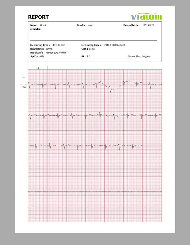 Viatom Checkme Pro ECG-Monitor/Recorder - The most versatile Medical ...